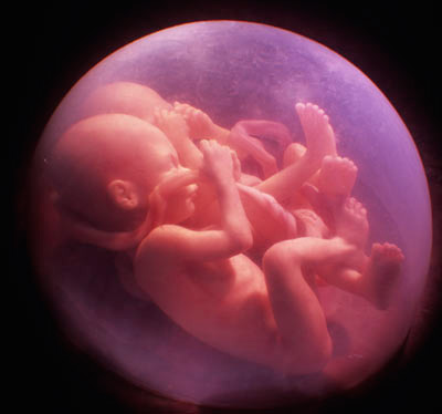 Embarazos Múltiples - Tener más de un bebé - Ser Mamá